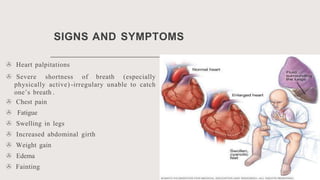 cardiomegaly-201230142934.pptx