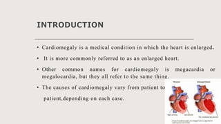 Cardiomegaly | PPTX