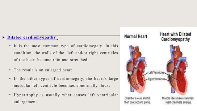 Etiology of cardiomegaly the heart- (2).pptx