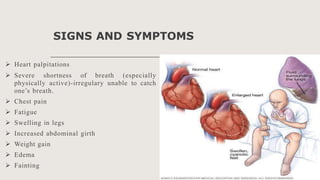 Etiology of cardiomegaly the heart- (2).pptx
