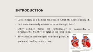 Etiology of cardiomegaly the heart- (2).pptx