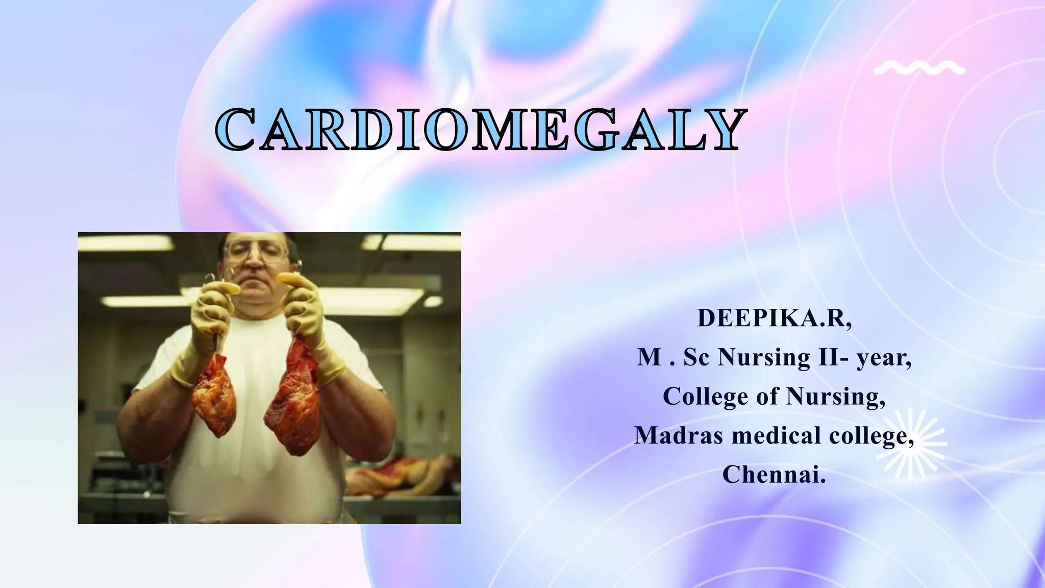 cardiomegaly.pptx, DEEPIKA.R, M. Sc nursing. | PPT