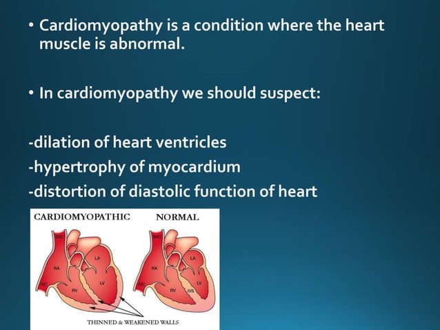 Cardiomyopathy - clinical findings | PPTX | Heart and Cardiovascular ...