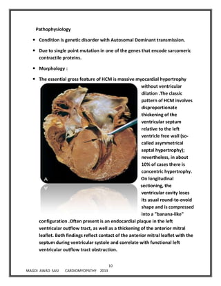 Cardiomyopathies | PDF