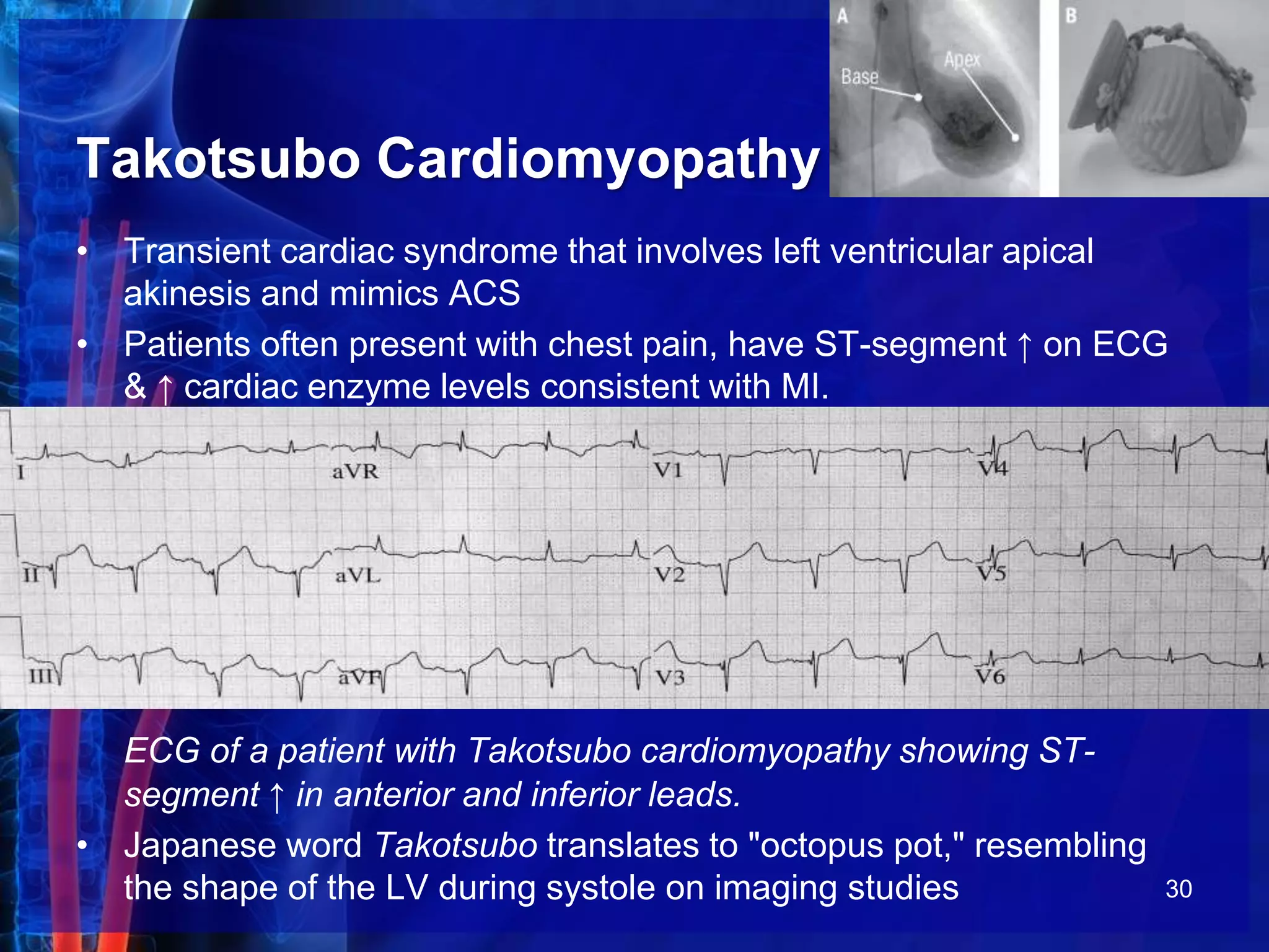 Cardiomyopathies | PPTX