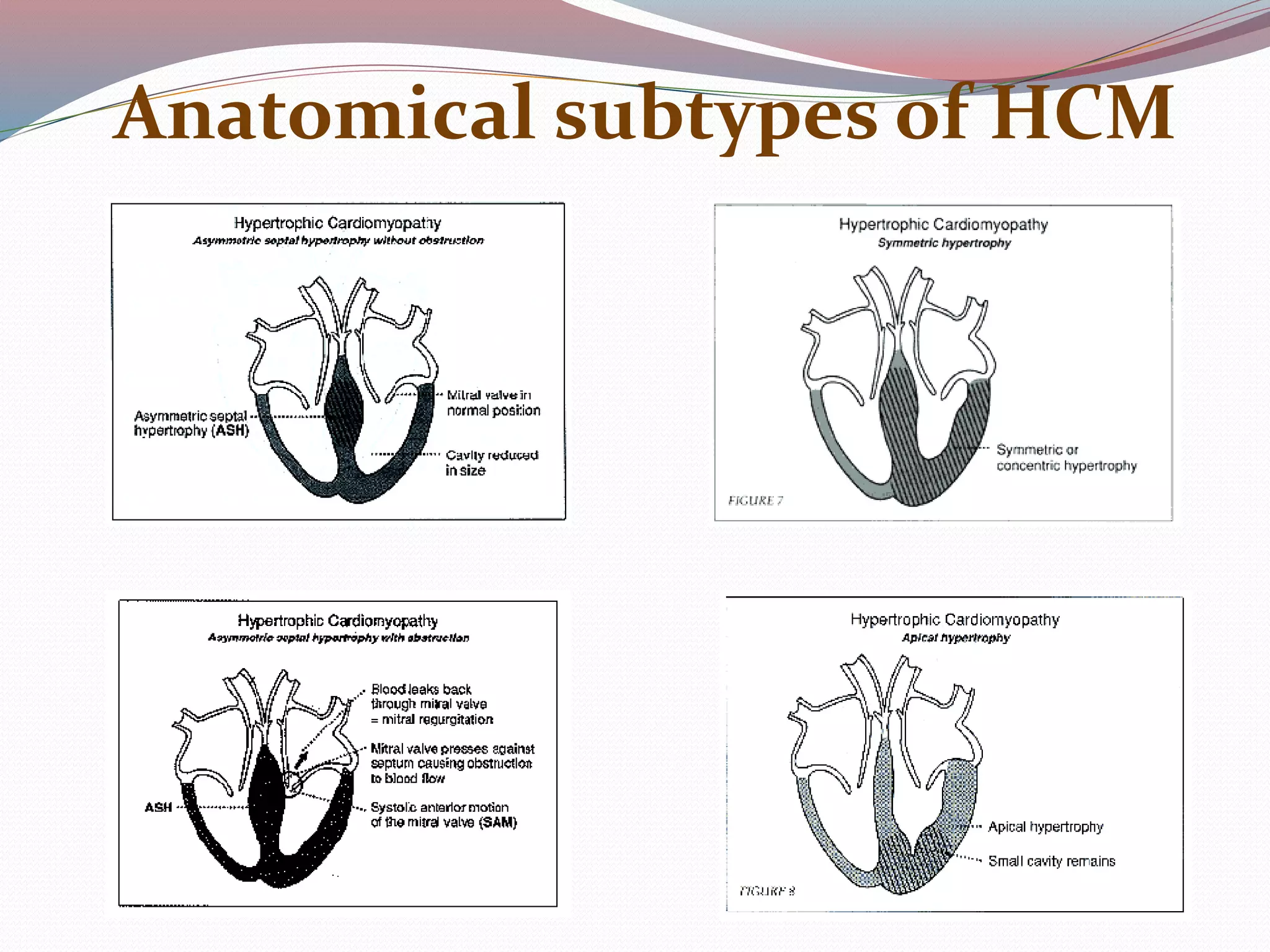 Cardiomyopathies | PPTX