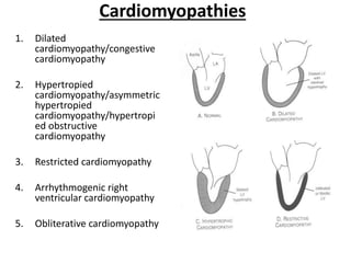 Cardiomyopathies | PPTX