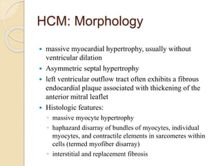 Cardiomyopathies | PPTX | Heart and Cardiovascular Diseases | Diseases ...