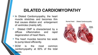 cardiomyopathies, types and nursing management.pptx