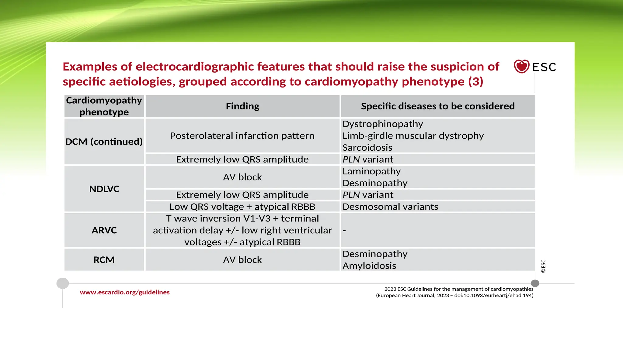 Seminar on cardiomyopathies including hocm | PPTX