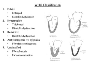 Cardiomyopathies and arrythmias | PPT