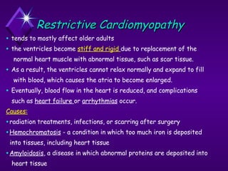 Cardiomyopathy | PPT