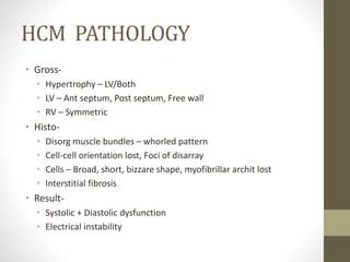 Cardiomyopathy | PPTX