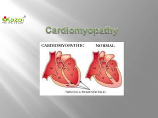 Cardiomyopathy | PPTX