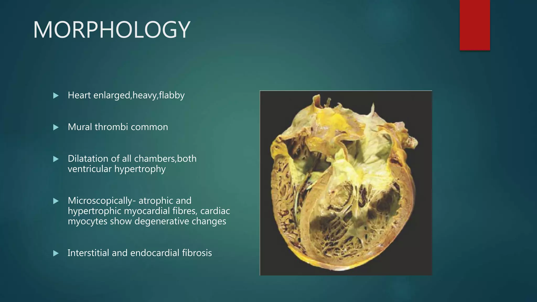 Cardiomyopathy | PPTX