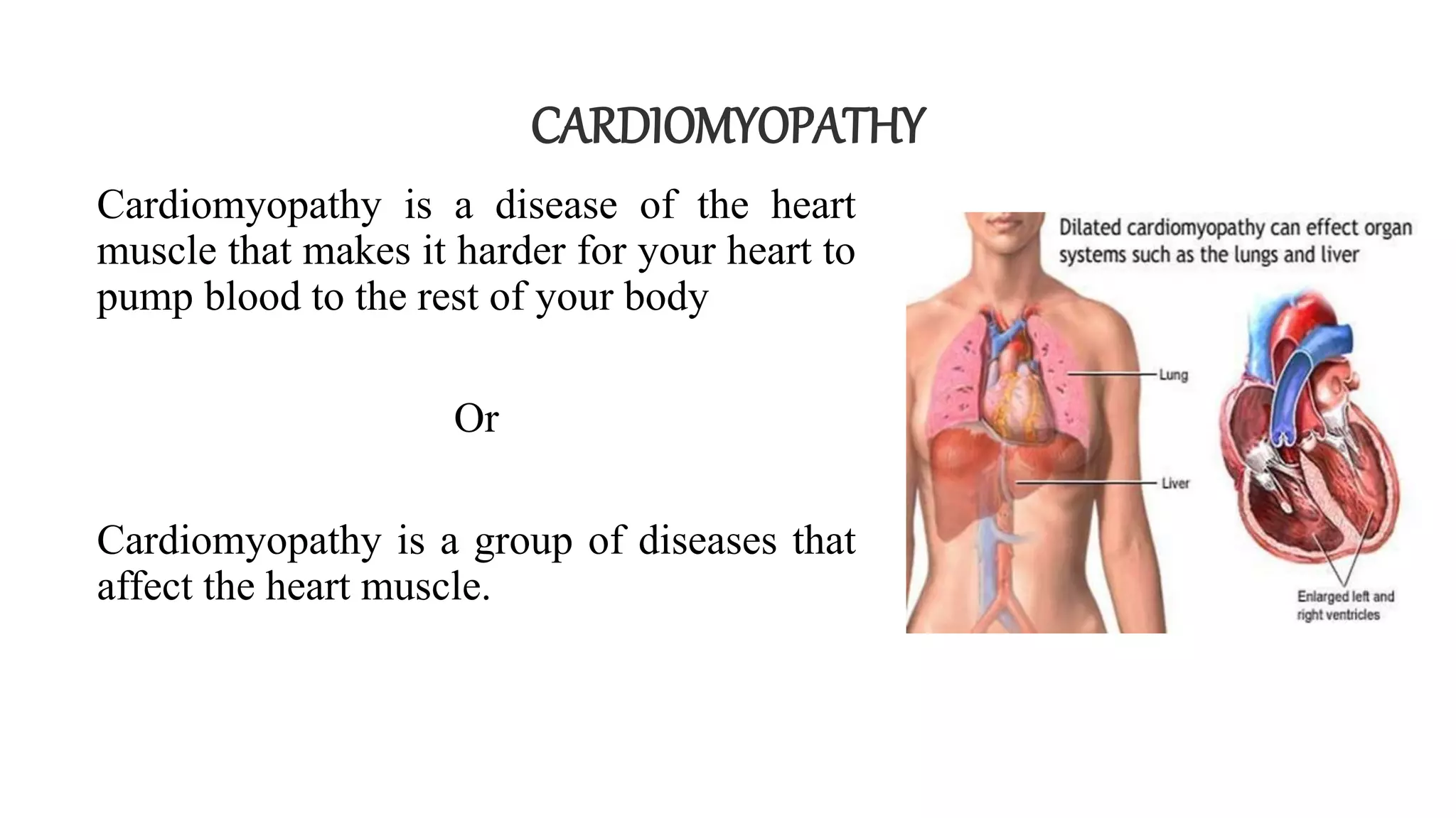 Cardiomyopathy | PPTX