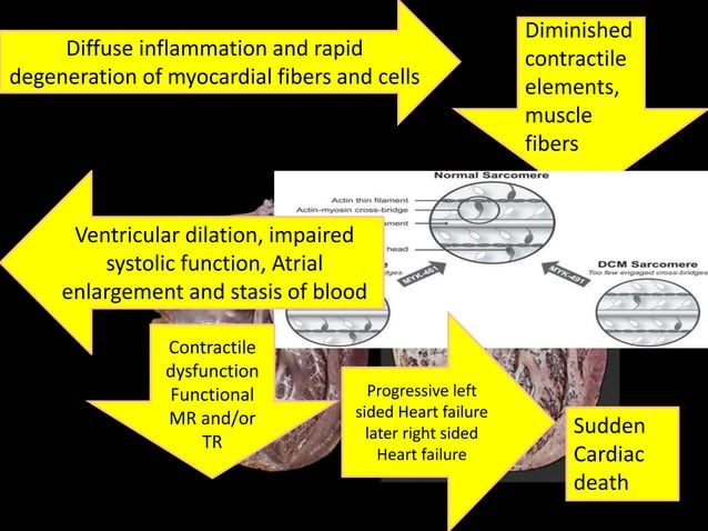 Cardio Myopathy.pptx | Heart and Cardiovascular Diseases | Diseases and ...