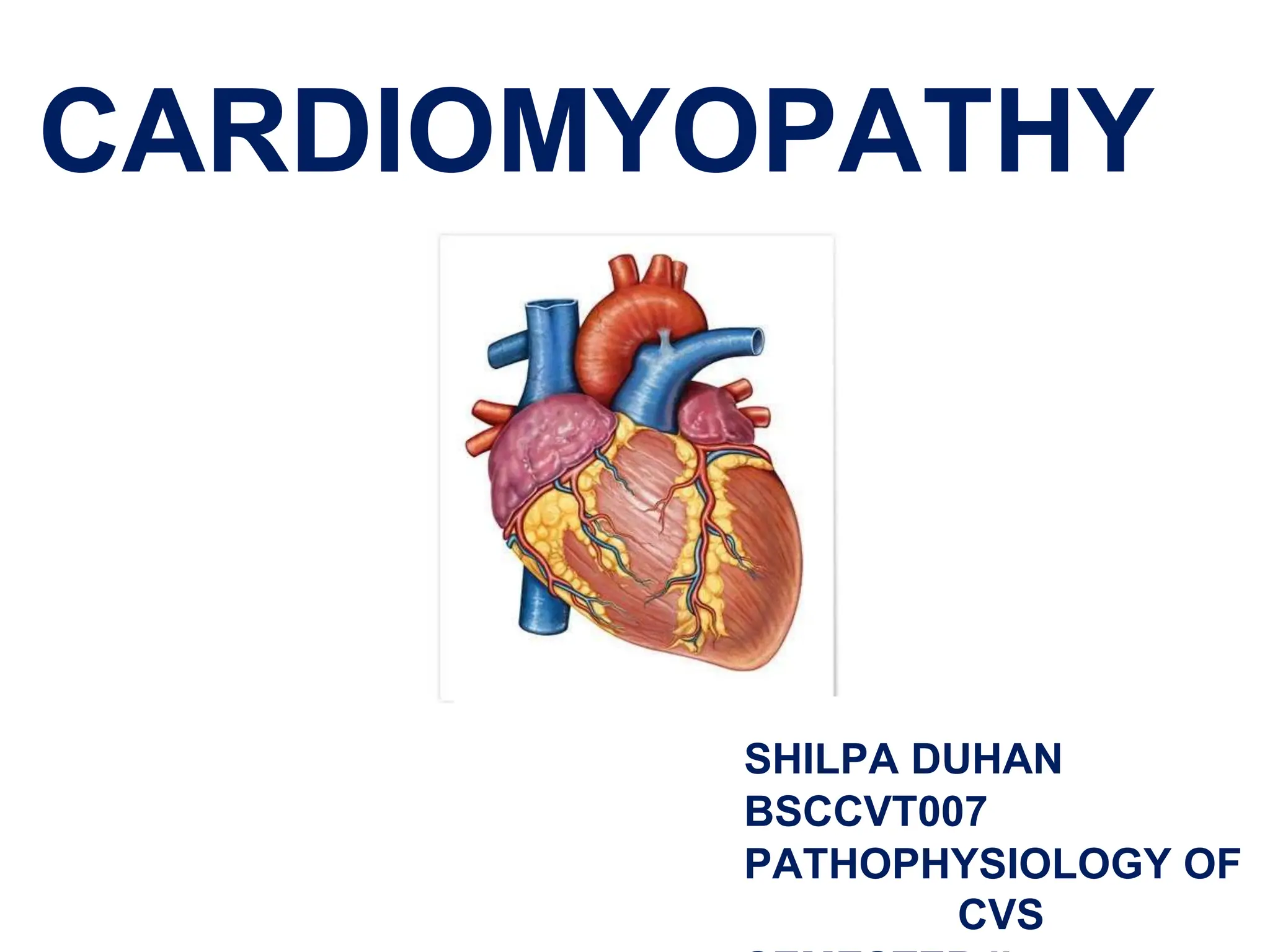 cardiomyopathy-converted-210922173513 (1).pptx