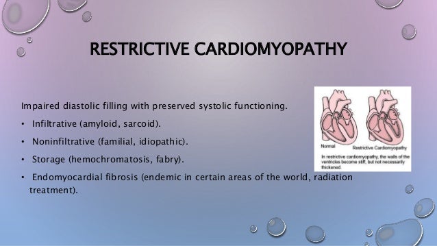 Cardiomyopathy