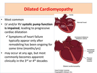 Cardiomyopathy - lecture.ppt