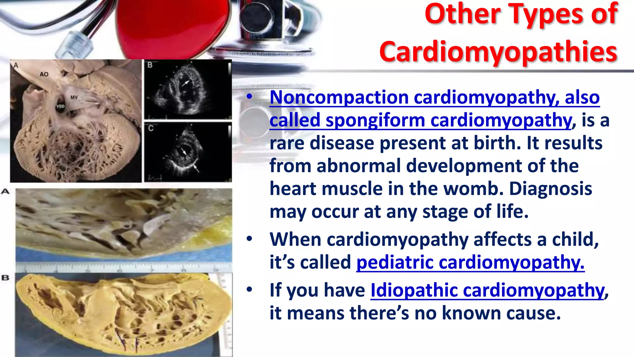 Cardiomyopathy | PPTX