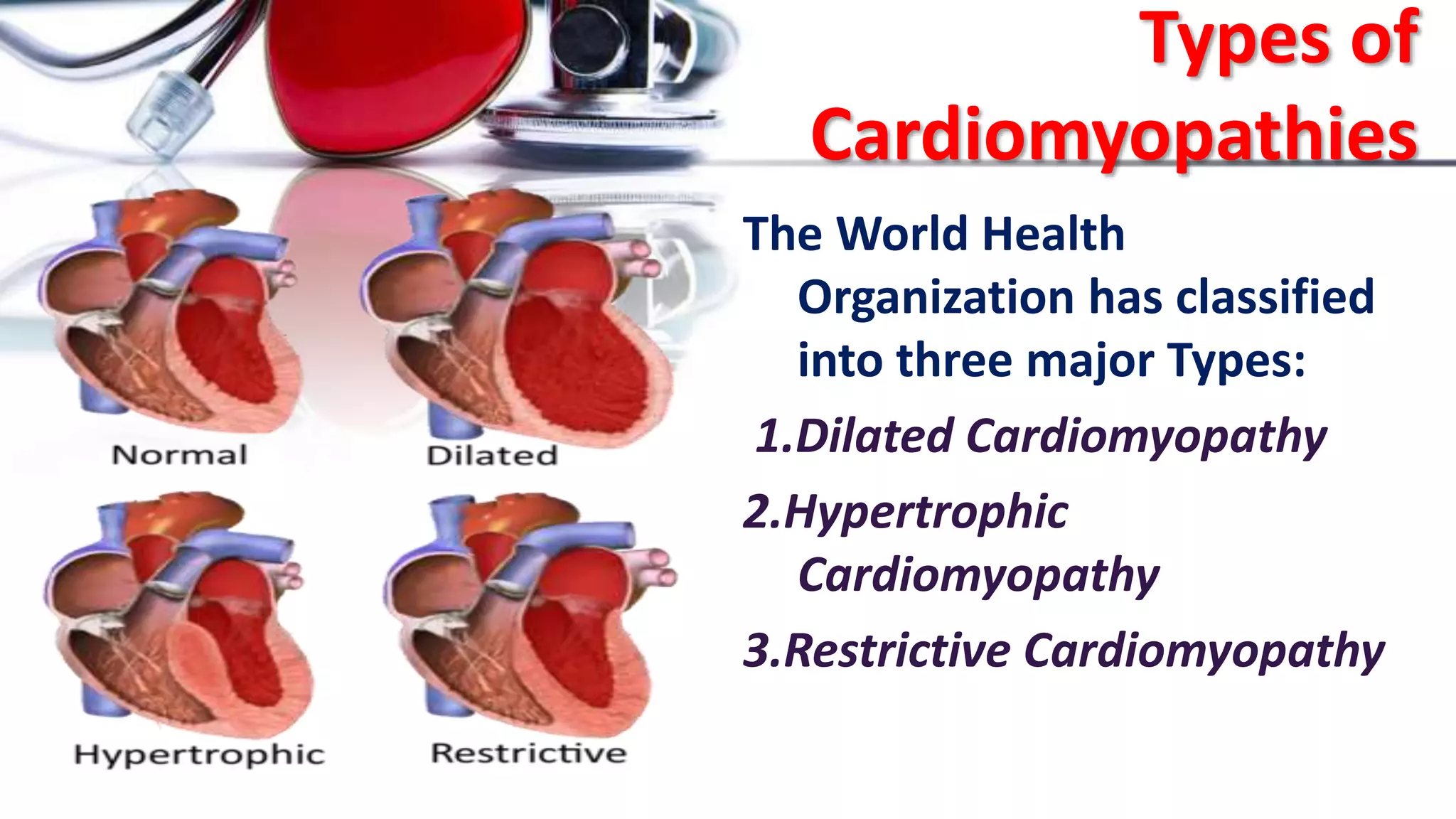 Cardiomyopathy | PPTX