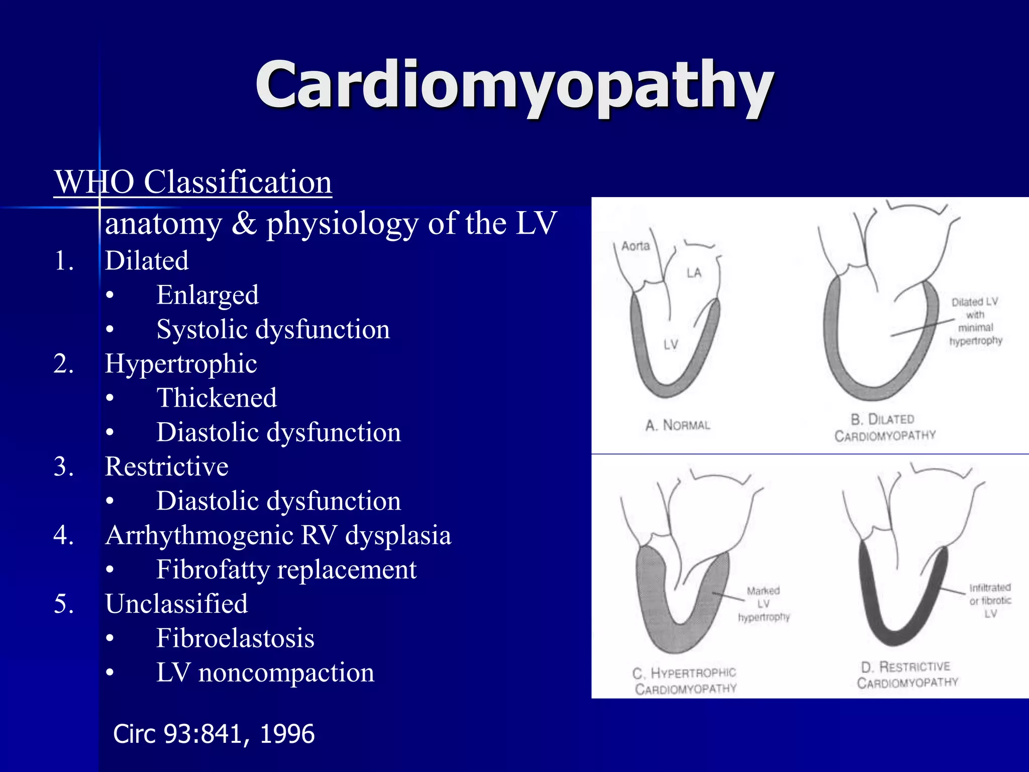 cardiomyopathy2.ppt
