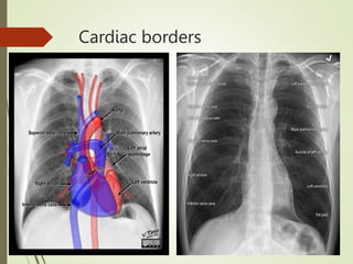 cardiomyopathy & aneurysm first semester.pptx