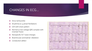 Cardiomyopathy by dr sajid.pptx