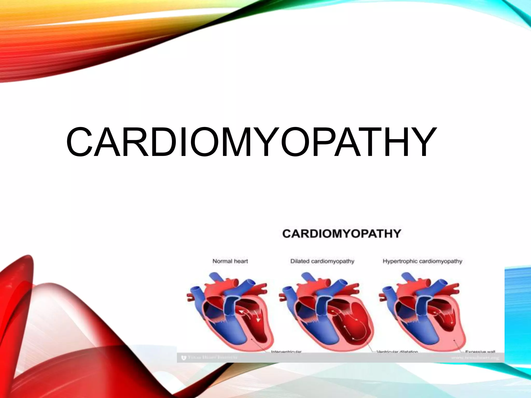 Cardiomyopathy | PPTX