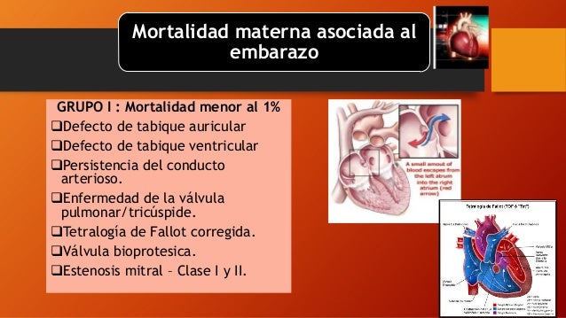 Cardiopatia En El Embarazo