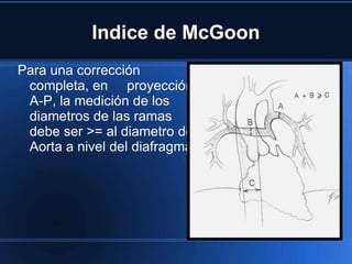 Cardiopatias congenitas tetralogia de fallot | PPTX