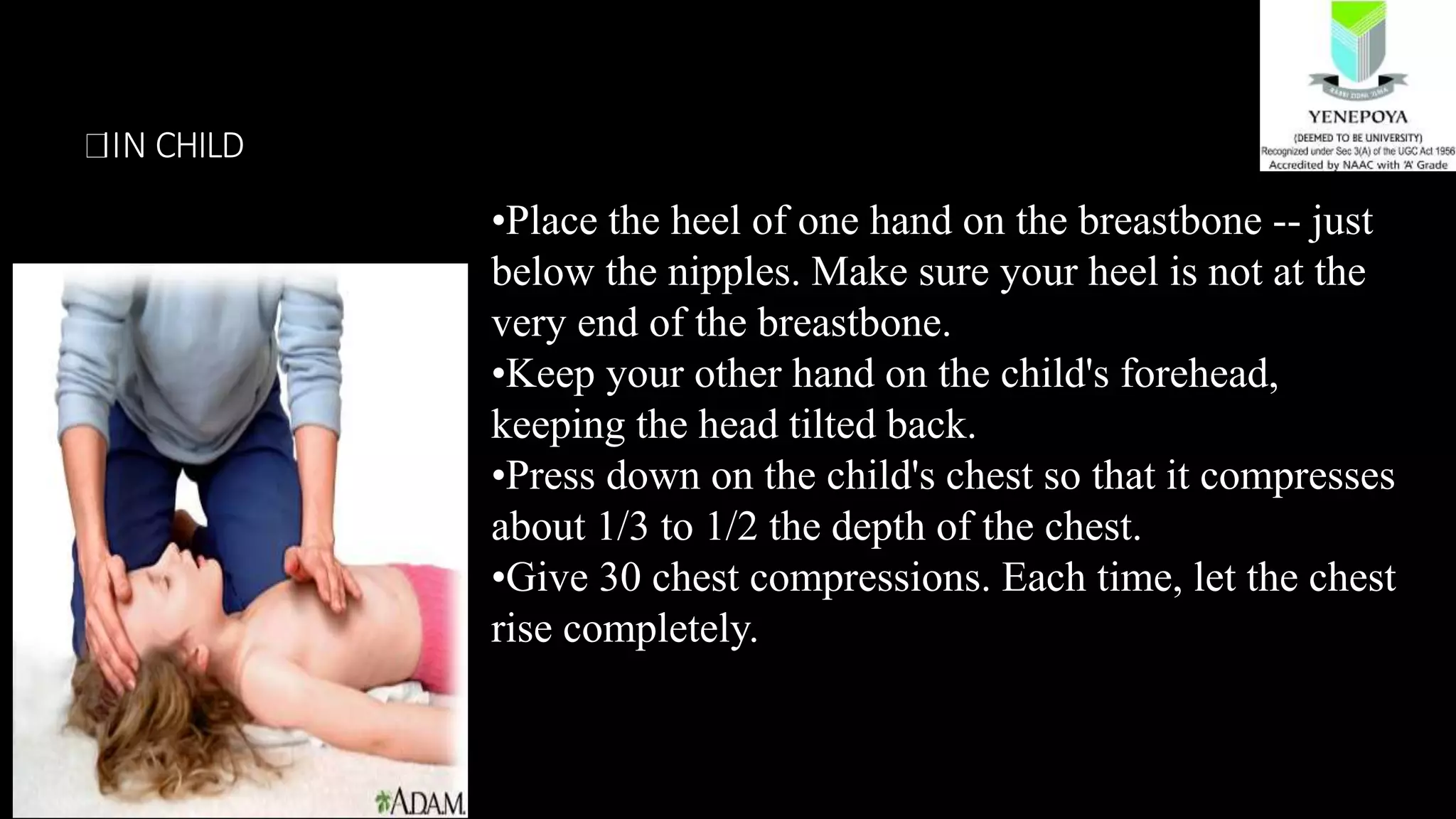 Cardiopulmonary RESUSITATION | PPT