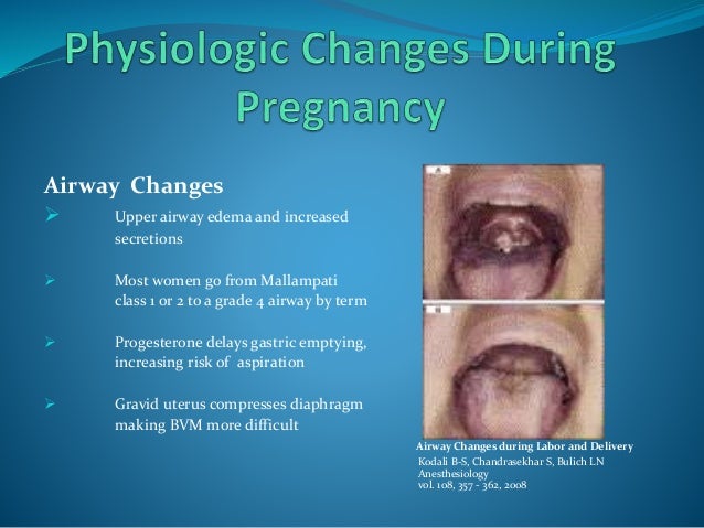 Cardiopulmonary%20 resuscitation%20during%20pregnancy