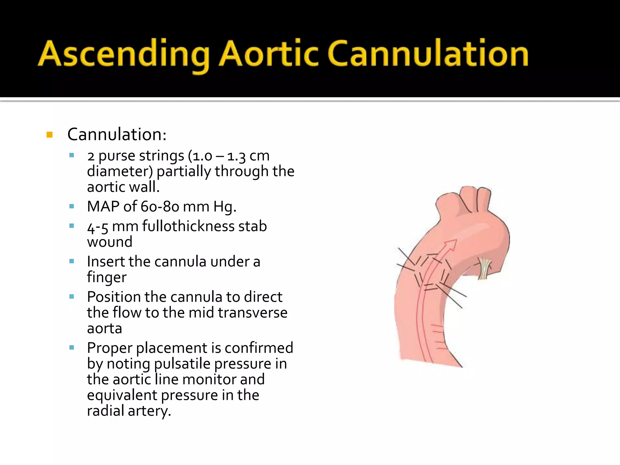 Cardiopulmonary bypass | PPTX