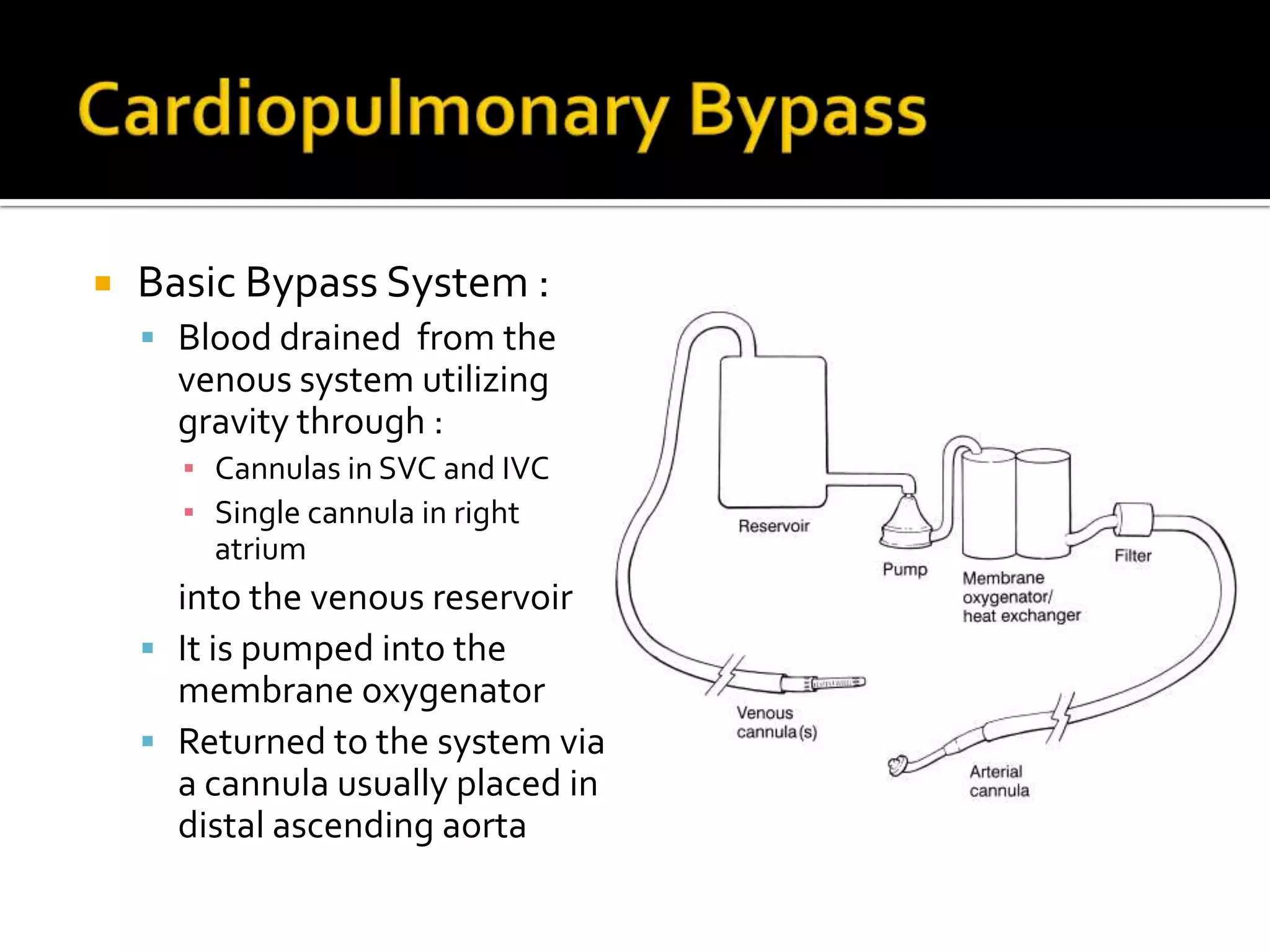 Cardiopulmonary bypass | PPTX