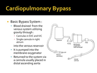 Cardiopulmonary bypass | PPTX