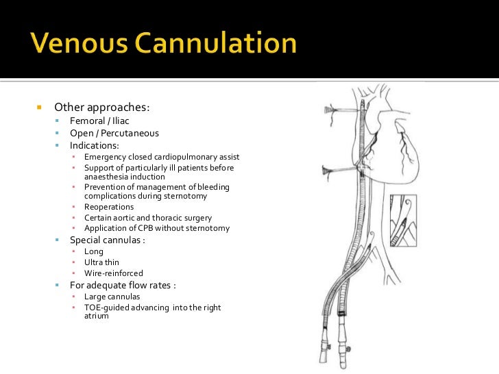 Cardiopulmonary bypass
