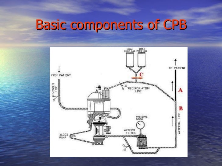 Cardiopulmonary bypass