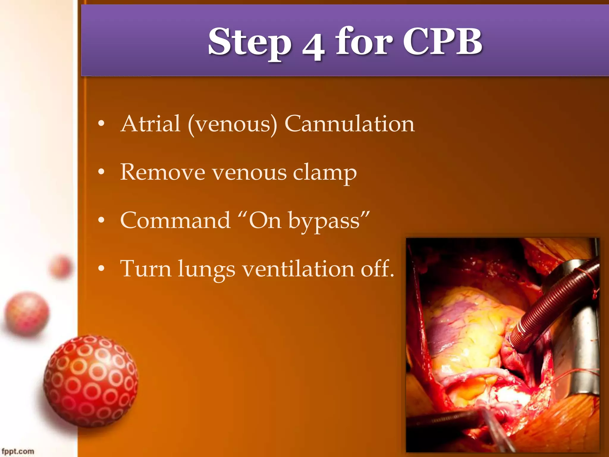 Cardiopulmonary Bypass Ppt