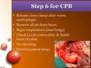 Cardiopulmonary bypass | PPT
