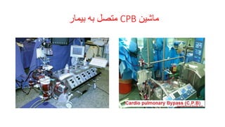 perfusionist and Cardio pulmonary bypass | PPT