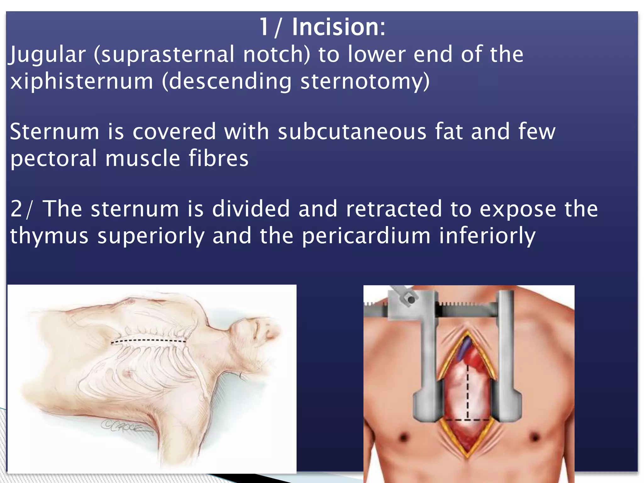 Cardiopulmonary bypass | PPTX
