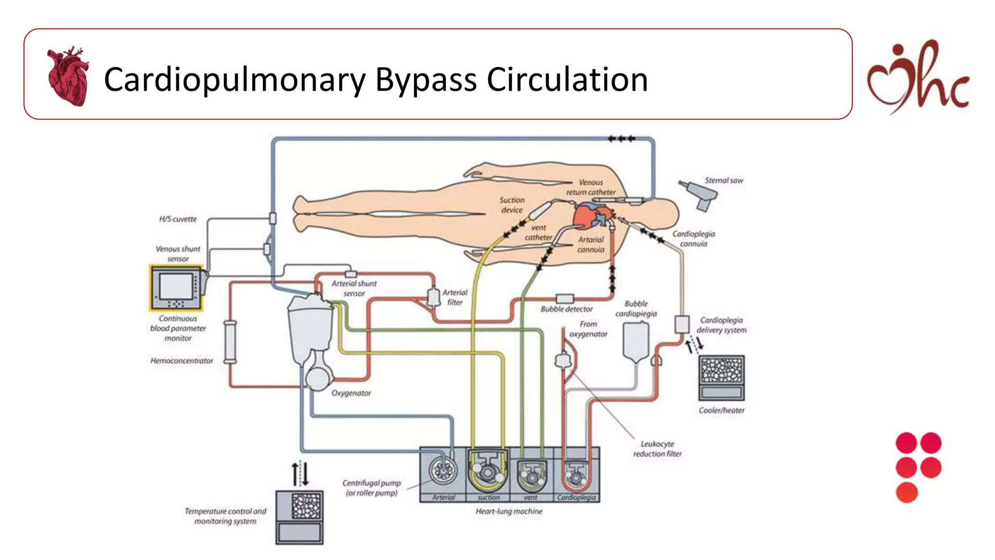 Cardiopulmonary Bypass.pptx