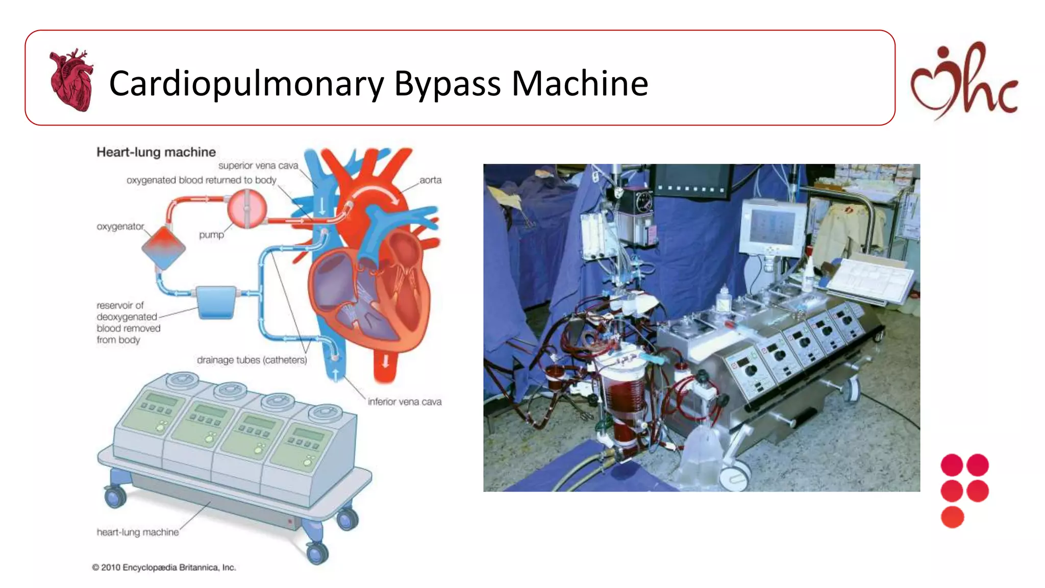 Cardiopulmonary Bypass.pptx