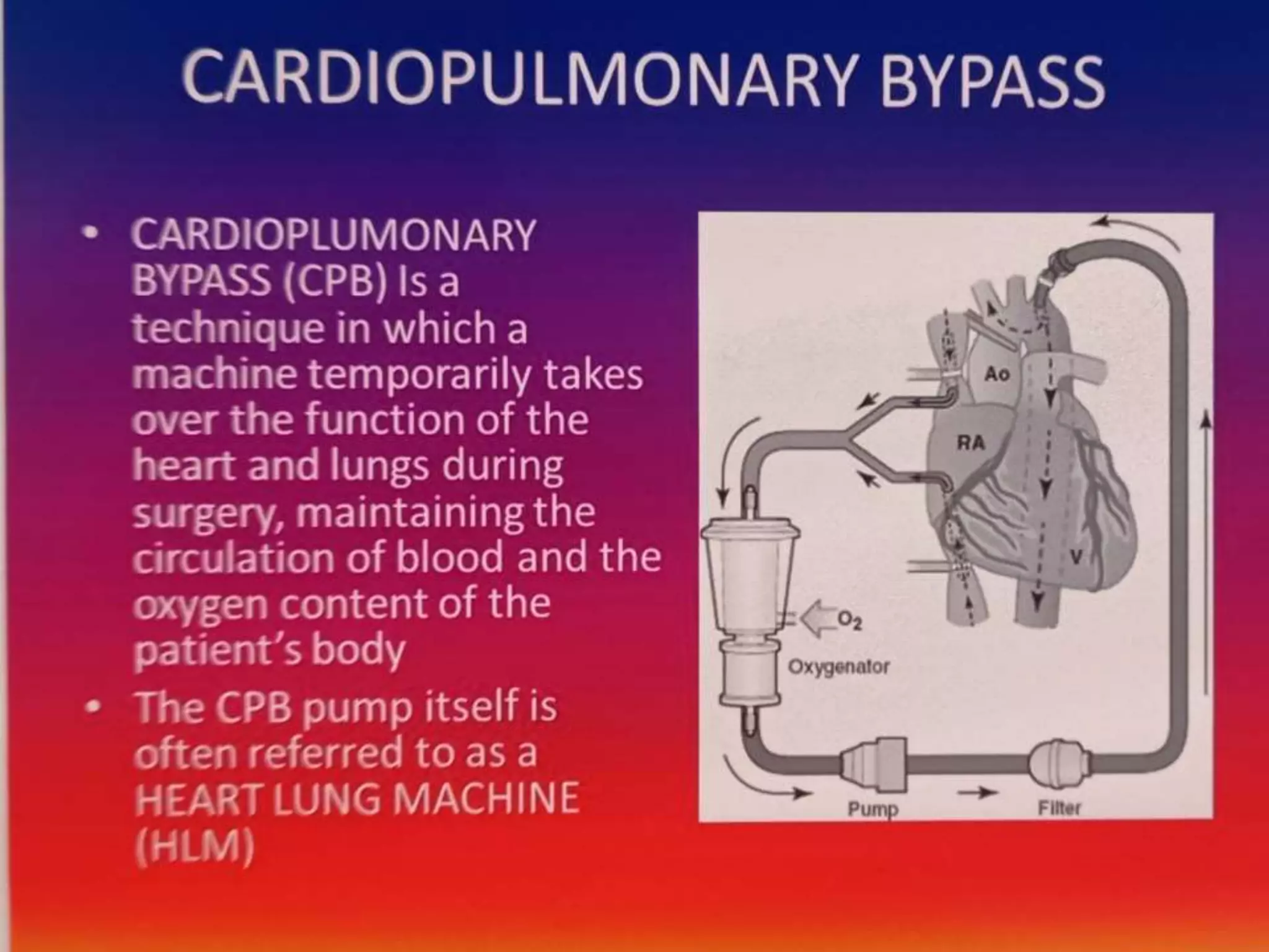 Cardio Pulmonary Bypass.pptx