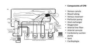 Cardiopulmonary bypass: Basic circuit, anticoagulation, blood ...