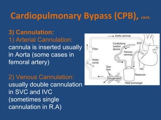 Cardiopulmonary Bypass and Valvular Surgery | PPT