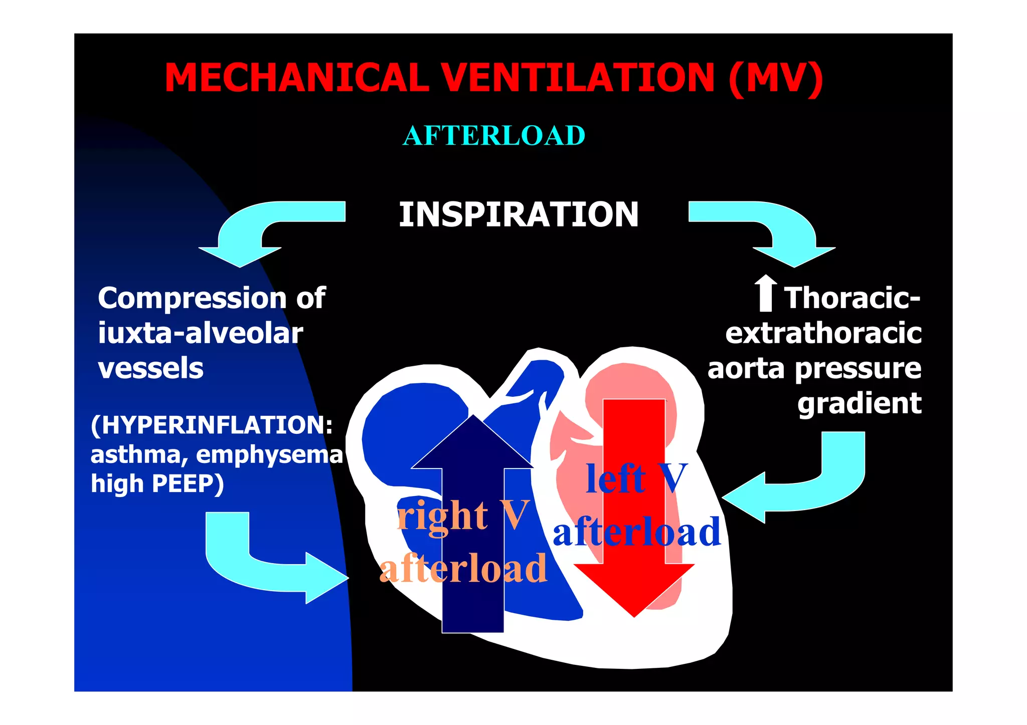 Cardio Pulmonary Interactions during Mechanical Ventilation | PDF