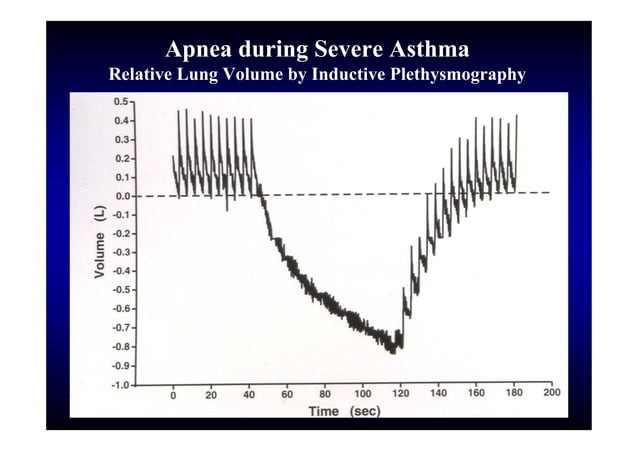 Cardio Pulmonary Interactions during Mechanical Ventilation | PDF